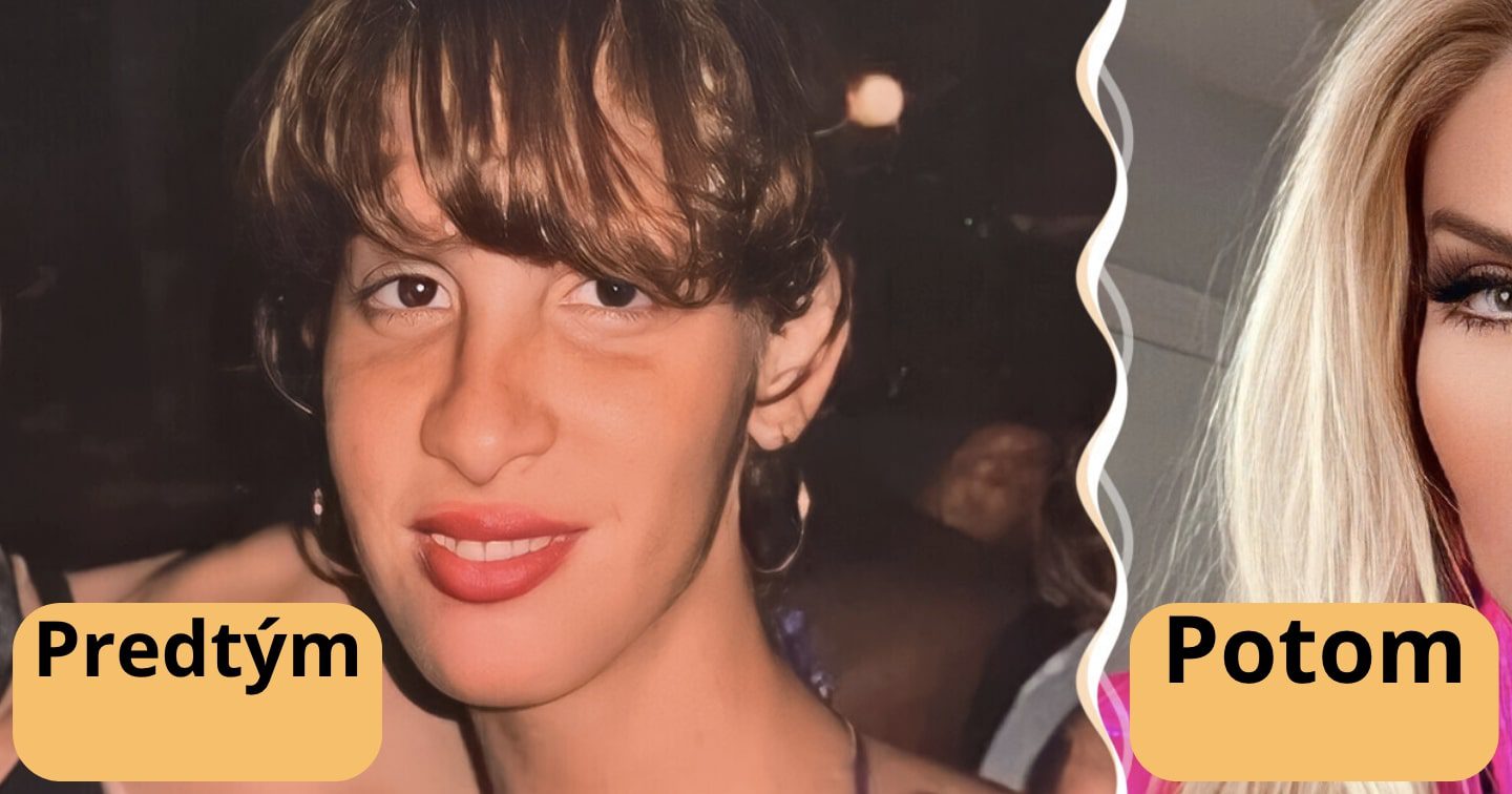 Žena minula milióny, aby vyzerala ako Barbie, a keď uvidíte jej "Kena ...