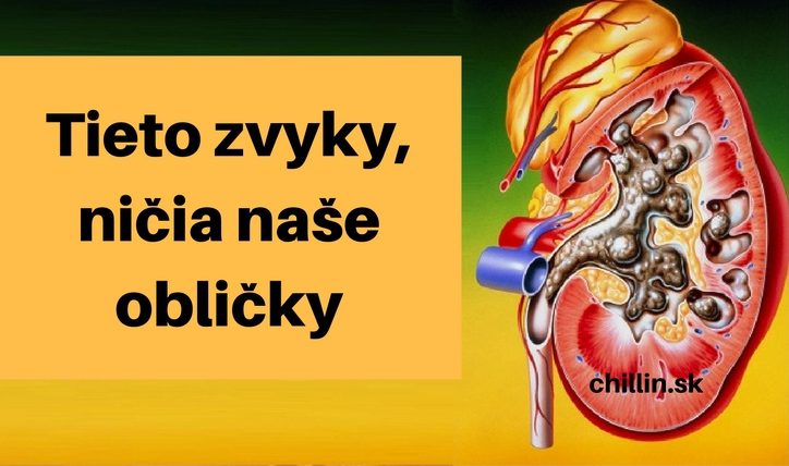 Svoje obličky si takto ničíme my sami! 10 zlozvykov, ktorých sa musíte ...